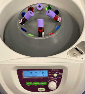 PRF/ STICKY BONE - Dr.Raúl Caffo Suárez